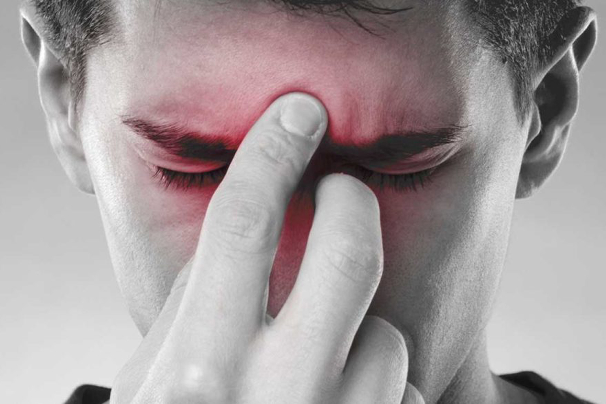 Qu'est ce qu'une sinusite ? - Actu Santé Fenua