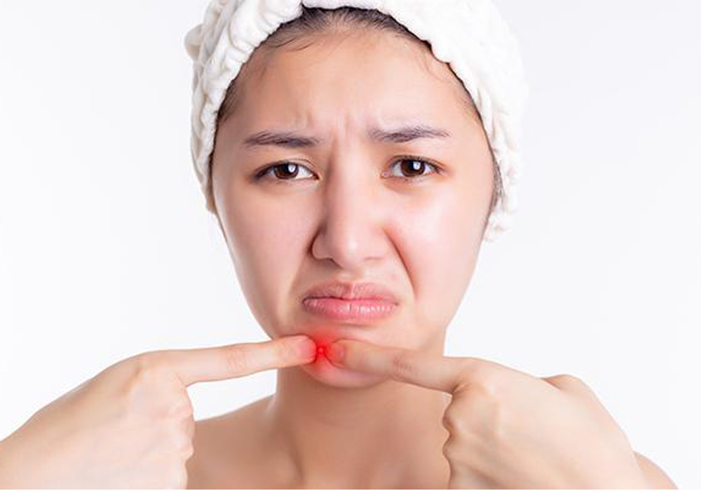 Comment soigner un bouton rouge sur le visage ? - Actu Santé Fenua