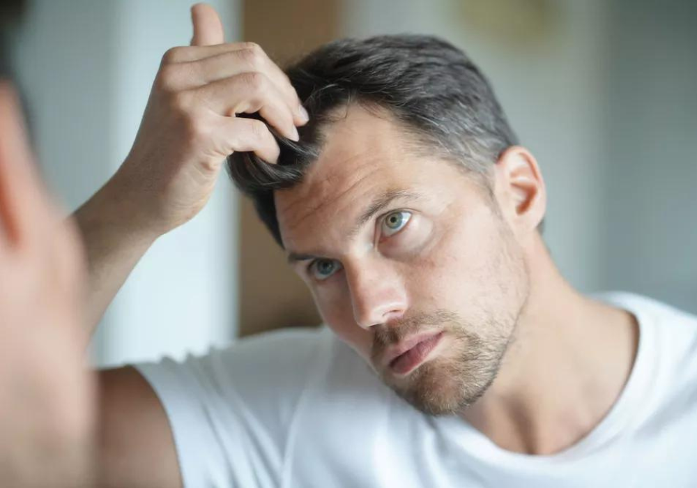 La perte de cheveux chez les hommes : les différentes causes - Actu ...