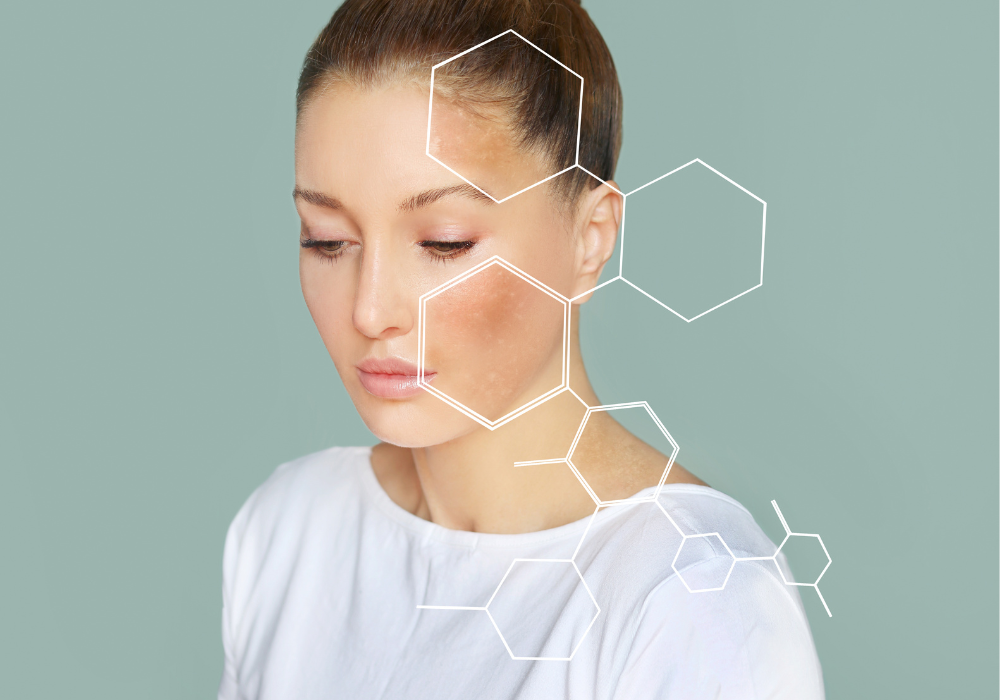 Les effets méconnus de l'alcool sur la santé de votre peau ! - Actu ...