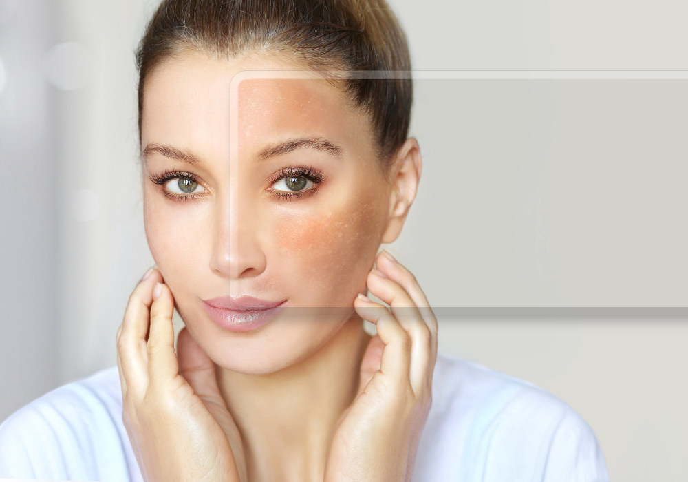 L'impact de l'alcool sur votre peau : La vérité dévoilée ! - Actu Santé ...